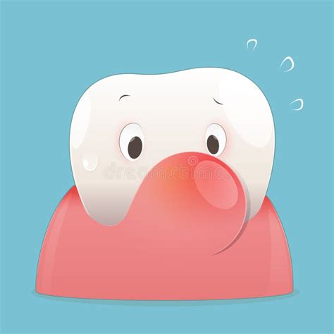 Periodontal Disease Illustration Stock Vector Illustration Of Dentist