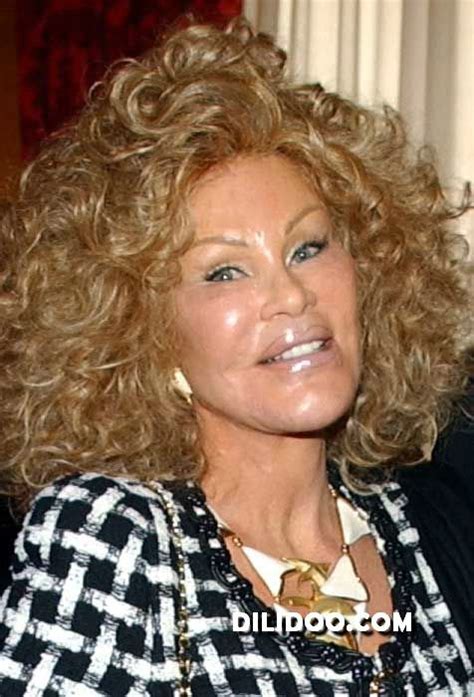 When Plastic Surgery Fails Pics Izispicy
