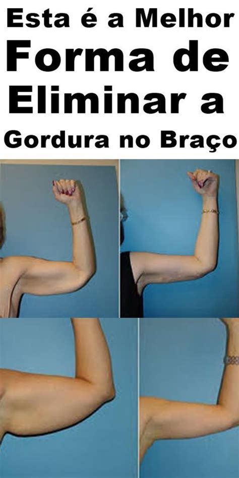 Creme caseiro para eliminar a gordura dos braços em 10 minutos Perder