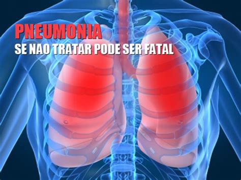 O Que Pneumonia