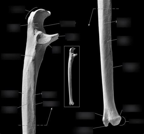 Ulna Lateral Diagram Quizlet