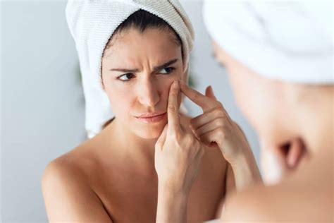 caractéristiques causes et remèdes naturels Conseils Beauté Santé