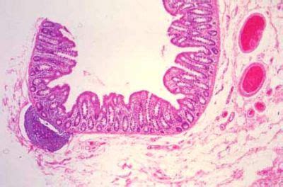 Large Intestine Histology Large Intestine Histology Slide