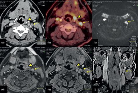 Diseases Of The Head And Neck Radiology Key