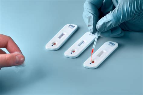 Tests R Pidos Diagn Sticos Para Covid En Oficina De Farmacia