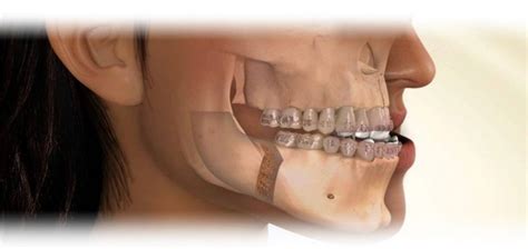 Cirurgia Buco Maxilo Facial Clínica G7 Implantes
