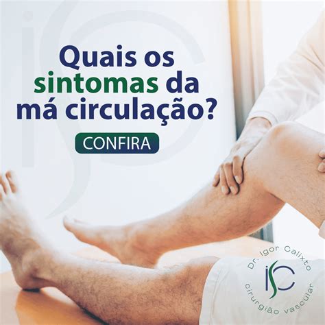Má circulação Saiba quais os sintomas Dr Igor Calixto