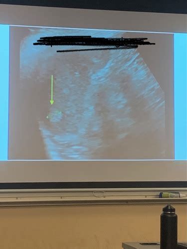 DMS Abdomen Exam 2 Images Flashcards Quizlet
