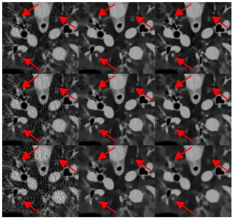 sensors free full text low dose ct image reconstruction based on structure tensor total