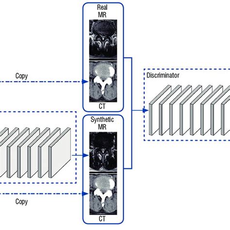 pdf spine computed tomography to magnetic resonance image synthesis using generative