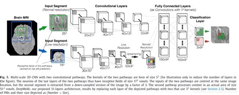 【论文笔记】efficient multi‐scale 3d cnn with fully connected crf for accurate brain lesion