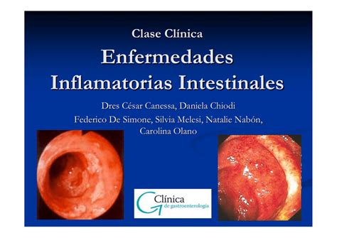 Clase Cl Nica Enfermedades Inflamatorias Intestinales