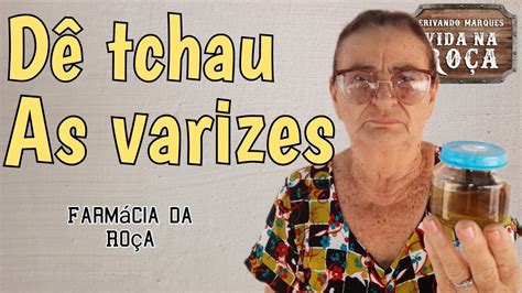 Acabe as varizes essa receitinha da vó Dalva YouTube