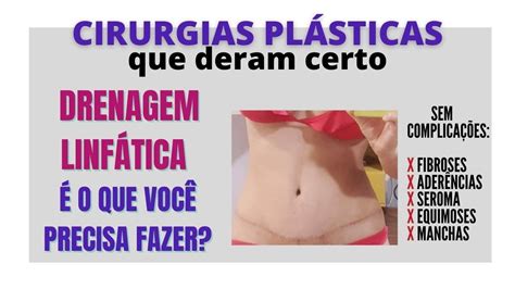 Drenagem Linfática no pós operatório É NECESSARIO para prevenir