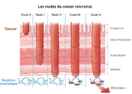 Actualite De La Medicine