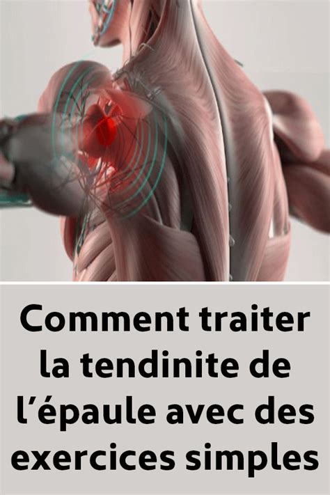 Comment traiter la tendinite de lépaule avec des exercices simples