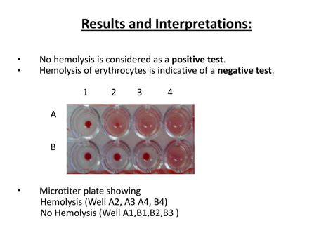 ppt complement fixation test powerpoint presentation free download id 2045042