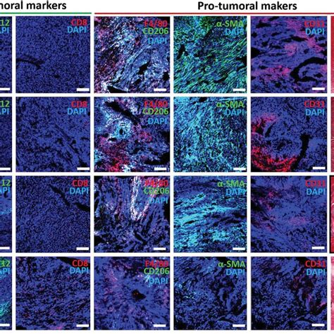 Treatmentinduced Modulation Of The Tumor Microenvironment The KPC