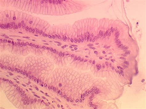 Gi Histology Flashcards Quizlet