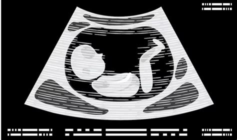 Usia Perkembangan Janin Trimester Pertama Bumil Wajib Tau