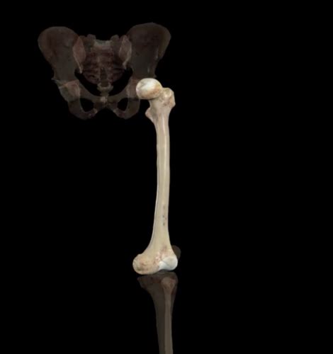 Anatomy Lab Lower Extremity Flashcards Quizlet