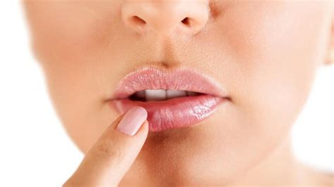 Por qué sale el herpes labial y cómo podemos cuidarlo