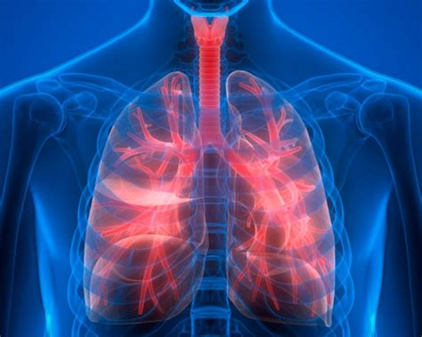Enfermedad pulmonar obstructiva crónica EPOC Centro médico