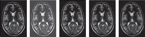 denoising results over medical image 2 a original medical image 2 download scientific