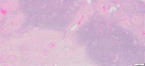 Human Ovary Normal FFPE Sections