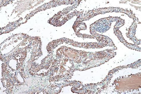 IHCeasy GSTM3 Ready To Use IHC Kit KHC0789 Proteintech 武汉三鹰生物技术有限公司