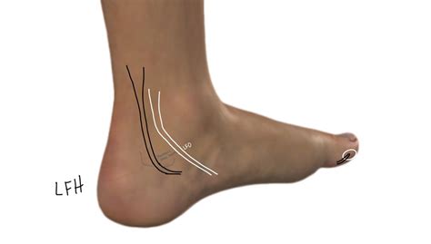 Long fléchisseur de l hallux LFH Diagram Quizlet