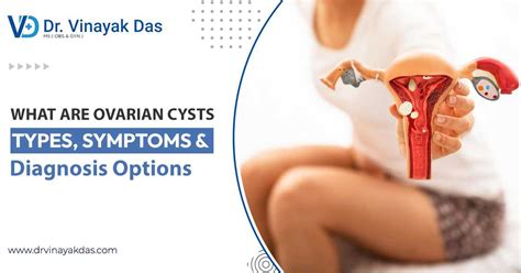 What Are Ovarian Cysts Types Symptoms Diagnosis Options Dr