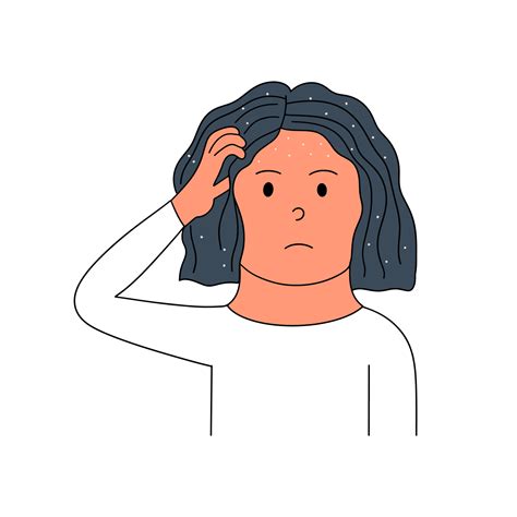 Woman Suffer From Dandruff On The Head Seborrheic Dermatitis