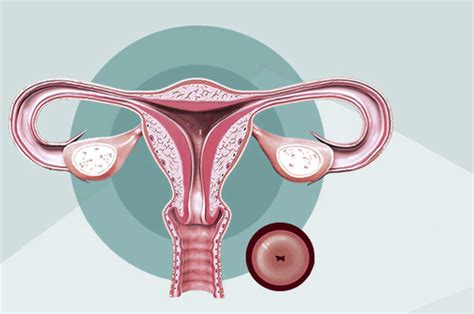Kanker Serviks Bisa Dicegah Dengan Pap Smear Begini Caranya Cewekbanget