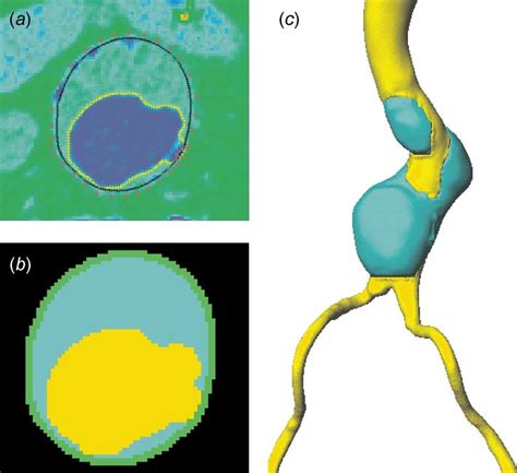 3d image segmentation and model reconstruction a… active contour download scientific diagram