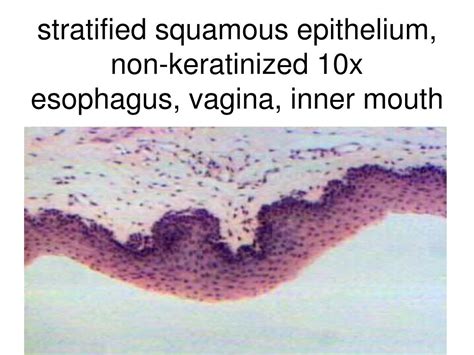 Stratified Squamous Epithelium Non Keratinized Esophagus