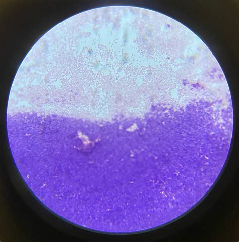 Docencia Microbiología UMHTinción de Gram Prácticas Microbiología UMH