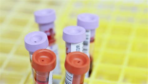Ho Il Linfoma Non Hodgkin Consigliato Nel Mio Caso Il Vaccino Per