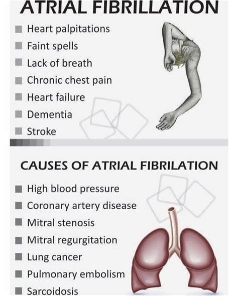 Symptoms And Causes Of Atrial Fibrillation Cardiac Nursing Medical