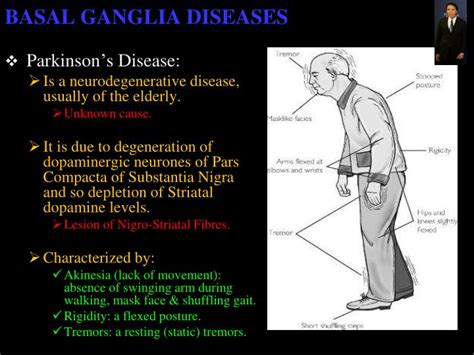 Basal Ganglia Disease