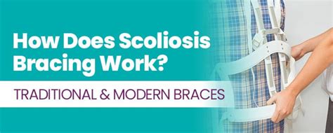 How Does Scoliosis Bracing Work Traditional Modern Braces