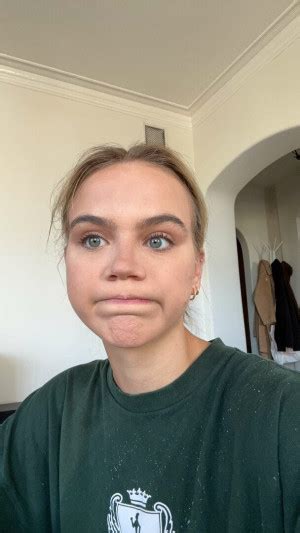 Emma Dental Nude Porn Pics And Xxx Videos