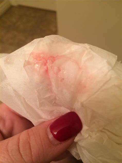 TMI Pic Is This Implantation Bleeding Glow Community