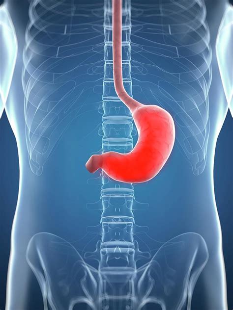 Inflamed Stomach Photograph By Sciepro Science Photo Library