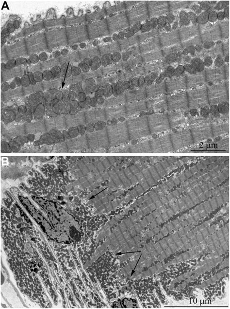 Ultrastructure Of Mitochondria In Skeletal Muscle Of 5 Year Old Naked