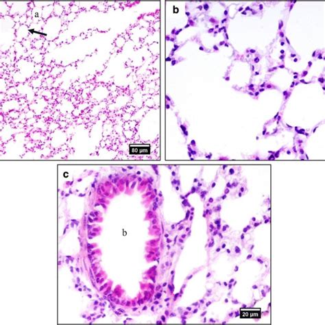 Photomicrographs Of H E Stained Sections Of Lungs Of Adult Rats Of The