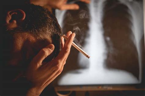 Qué es un enfisema pulmonar Síntomas causas y tratamiento