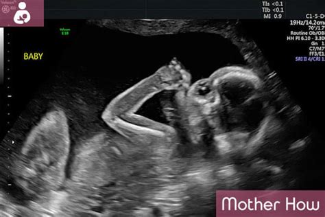 Weeks Pregnant Feelings Ultrasound Baby Development Motherhow