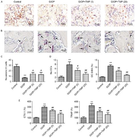 Tmp Promotes Osteogenesis And Inhibits Osteoclastogenesis In Vivo A