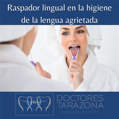 Lengua agrietada Es tu caso Clínica Dental Doctores Tarazona